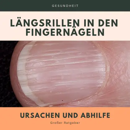 Längsrillen in den Fingernägeln | Ursachen und Abhilfe | Ratgeber